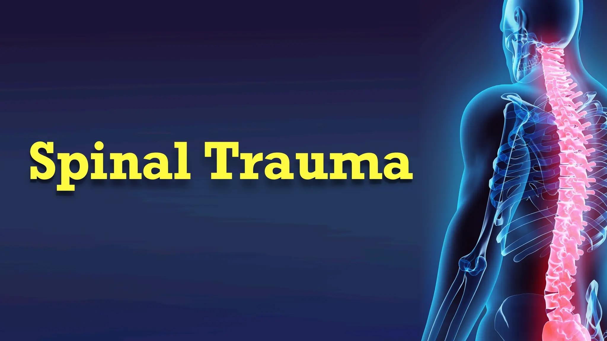 Spinal Trauma (a guide to diagnosis & Treatment) | PDF