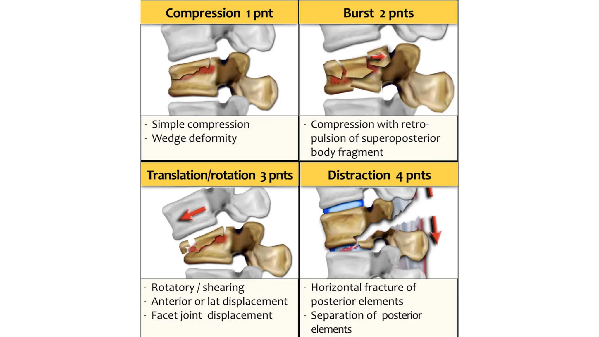 Spinal Trauma (a guide to diagnosis & Treatment) | PDF