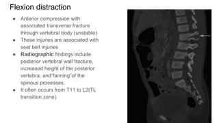 SPINAL TRAUMA ITS ANATOMY AND EMERGENCY MANAGEMENT OF | PPTX