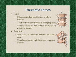 Spinal Trauma.pot of water in the water and | PPT