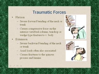 Spinal Trauma.pot of water in the water and | PPT
