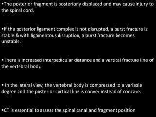 Spinal trauma IMAGING | PPTX