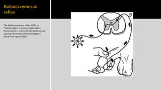 Spinal trauma wo anatomy | PPT