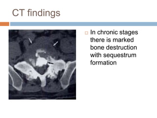 Spinal tuberculosis | PPTX