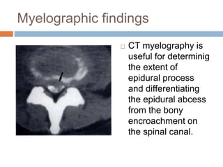 Spinal tuberculosis | PPTX