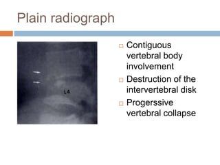 Spinal tuberculosis | PPTX