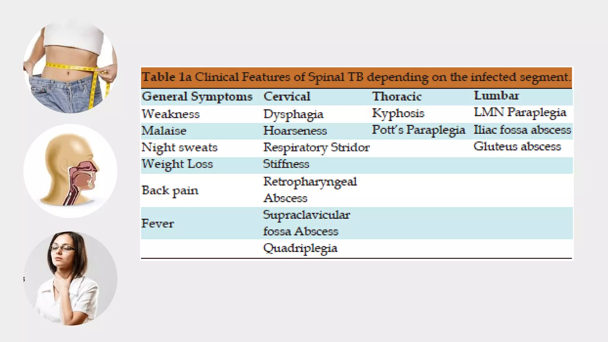 Spinal tuberculosis (simplified) | PPT