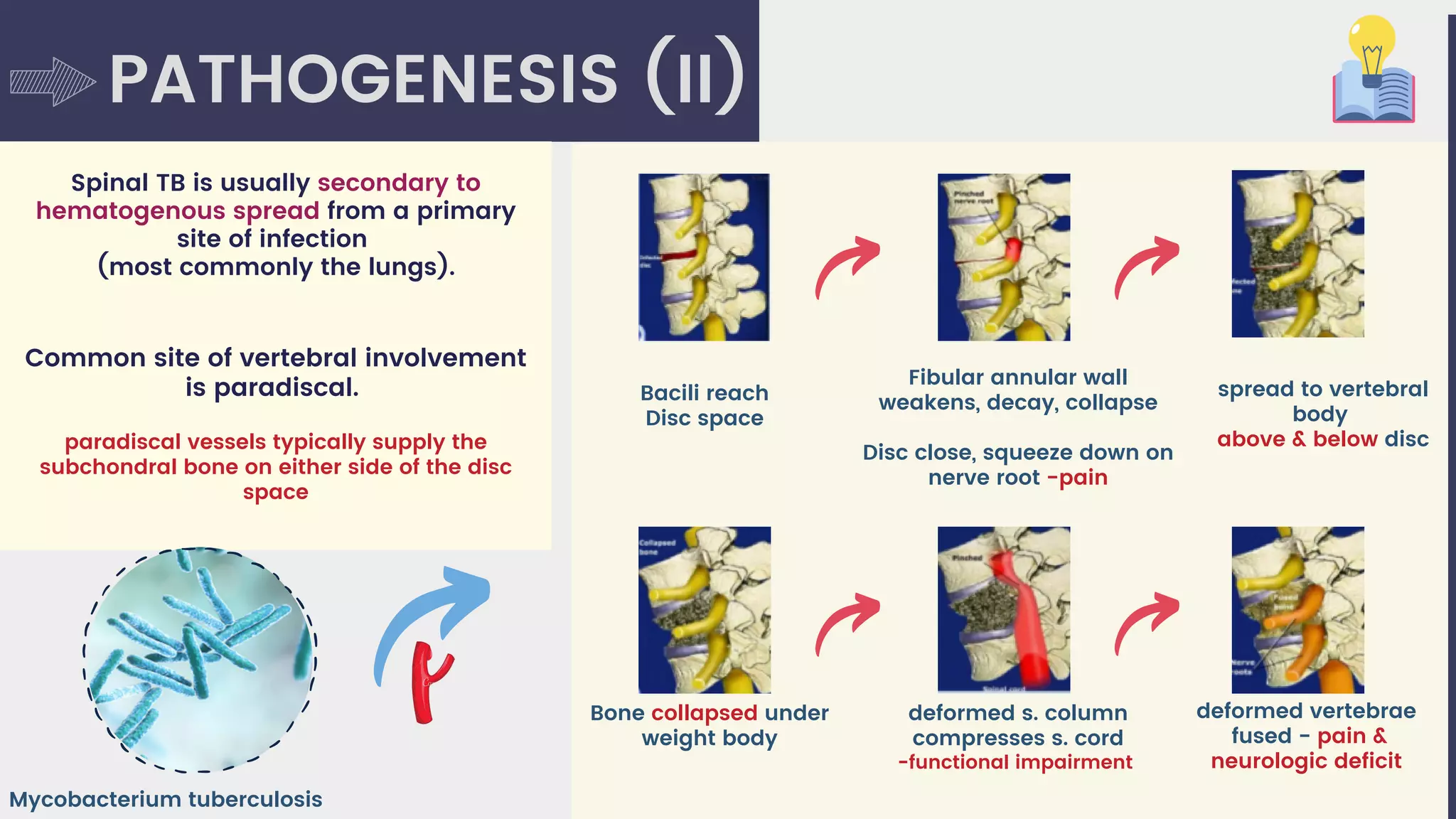 Spinal tuberculosis (simplified) | PPT