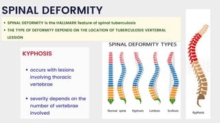 Spinal tuberculosis (simplified) | PPT