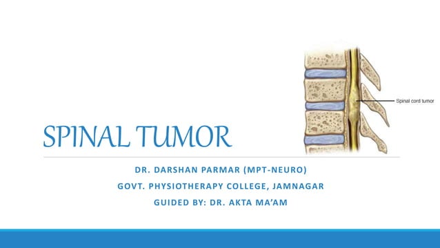 SPINAL TUMOR | PPTX