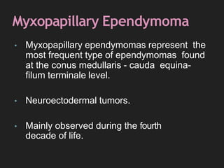 Imaging in spinal tumors | PPTX
