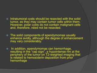 Spinal tumors- Imaging | PDF