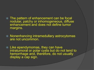 Spinal tumors- Imaging | PDF