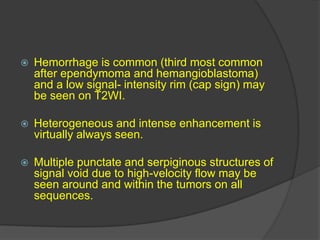 Spinal tumors- Imaging | PDF