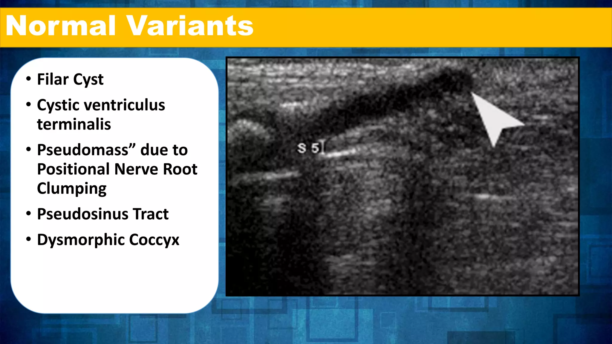 ULTRASOUND EXAMINATION OF INFANT SPINE - STEP BY STEP | PPTX