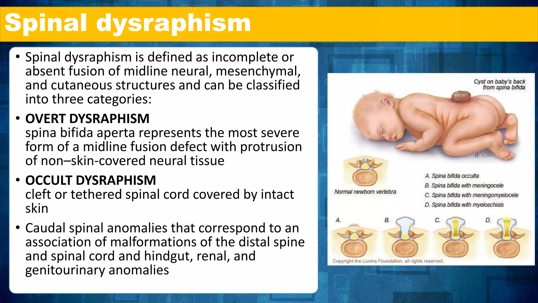 ULTRASOUND EXAMINATION OF INFANT SPINE - STEP BY STEP | PPTX
