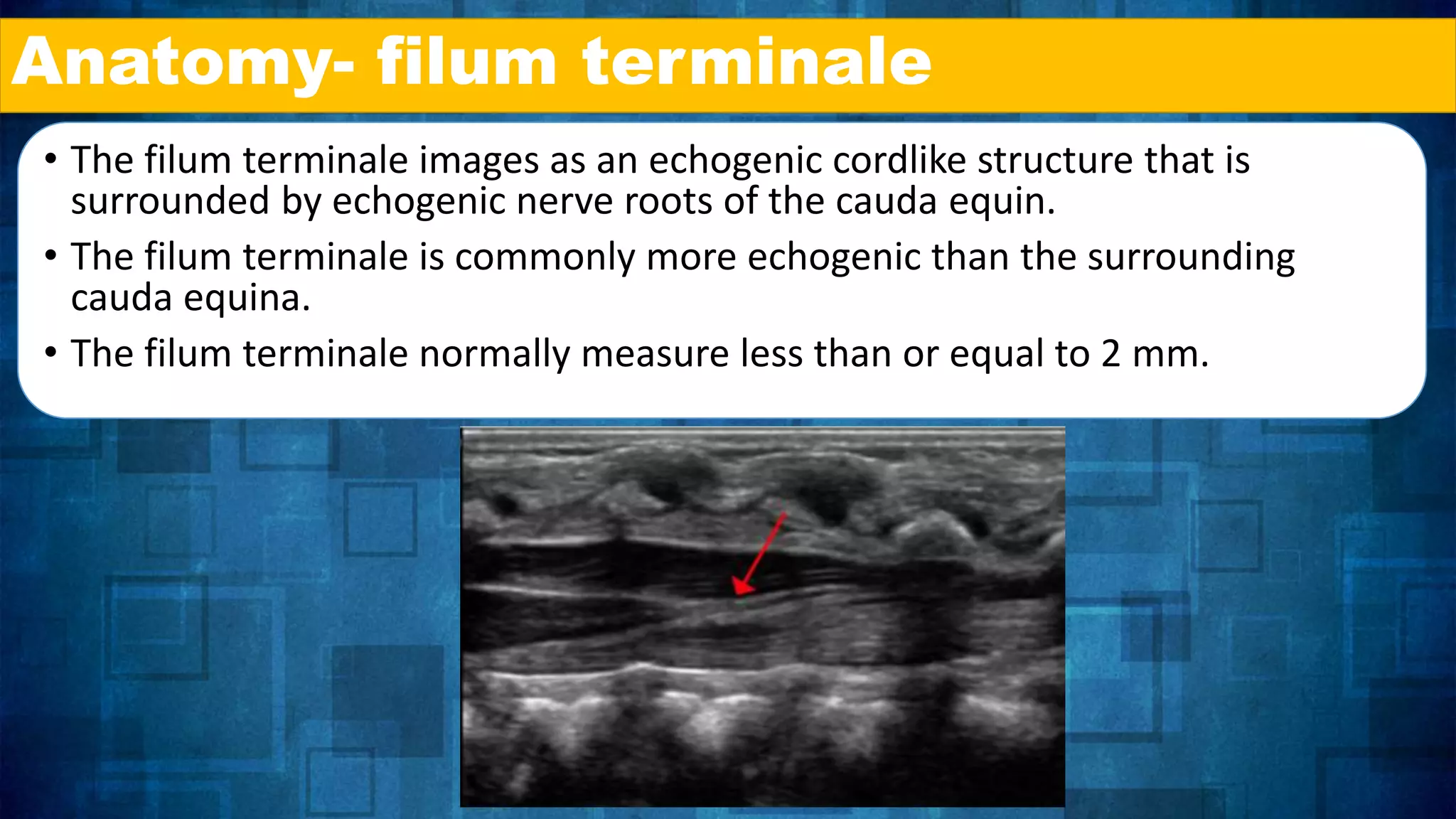 ULTRASOUND EXAMINATION OF INFANT SPINE - STEP BY STEP | PPTX