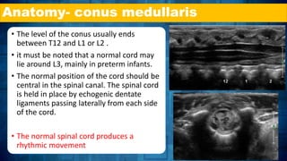 ULTRASOUND EXAMINATION OF INFANT SPINE - STEP BY STEP | PPTX