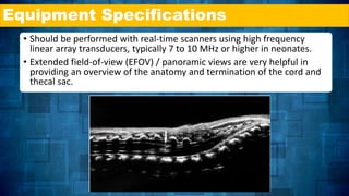 ULTRASOUND EXAMINATION OF INFANT SPINE - STEP BY STEP | PPTX