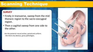 ULTRASOUND EXAMINATION OF INFANT SPINE - STEP BY STEP | PPTX