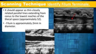 ULTRASOUND EXAMINATION OF INFANT SPINE - STEP BY STEP | PPTX