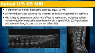 ULTRASOUND EXAMINATION OF INFANT SPINE - STEP BY STEP | PPTX