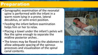 ULTRASOUND EXAMINATION OF INFANT SPINE - STEP BY STEP | PPT