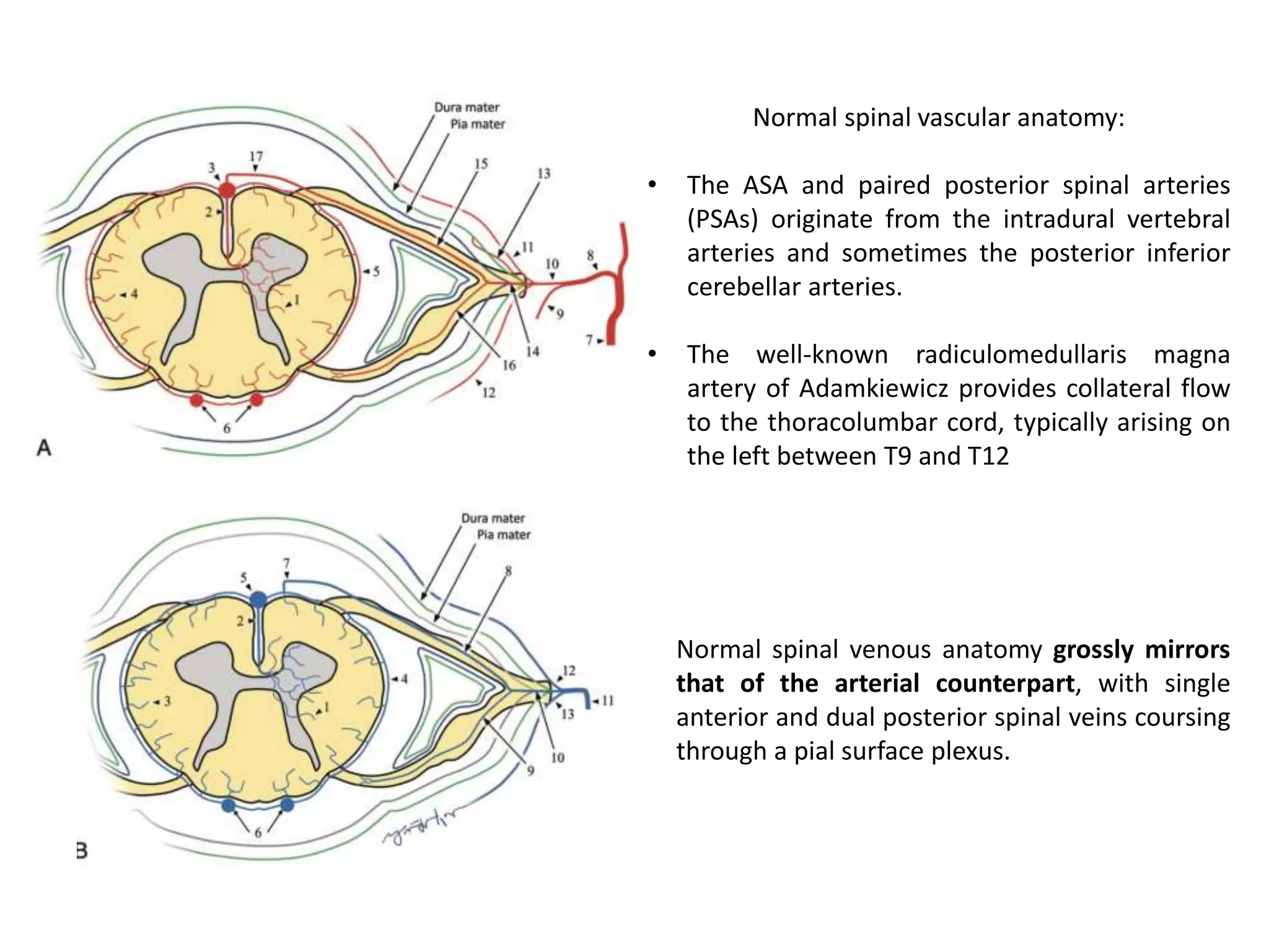 Spinal Vascular Shunts.pptx