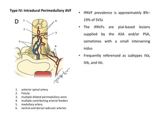 Spinal Vascular Shunts.pptx