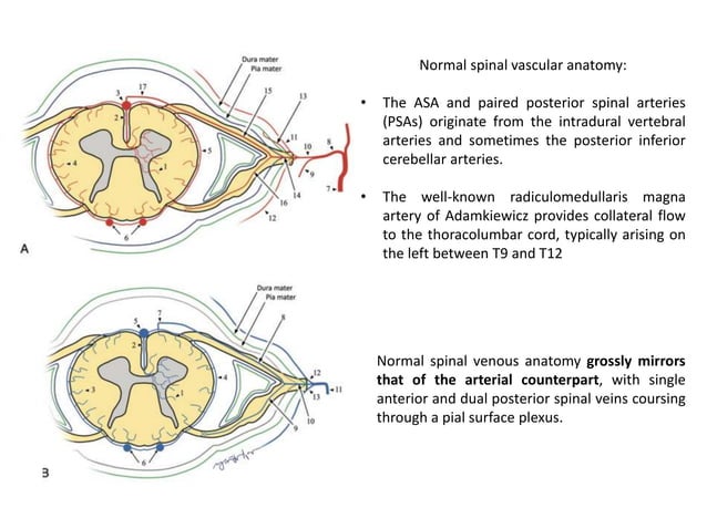 Spinal Vascular Shunts.pptx