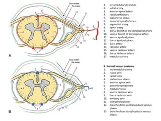 Spinal Vascular Shunts.pptx