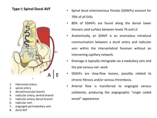 Spinal Vascular Shunts.pptx