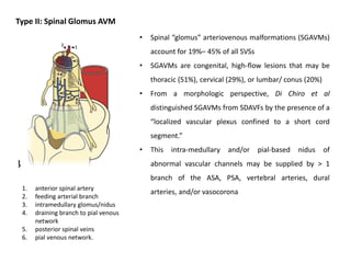 Spinal Vascular Shunts.pptx