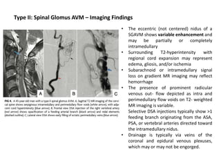 Spinal Vascular Shunts.pptx