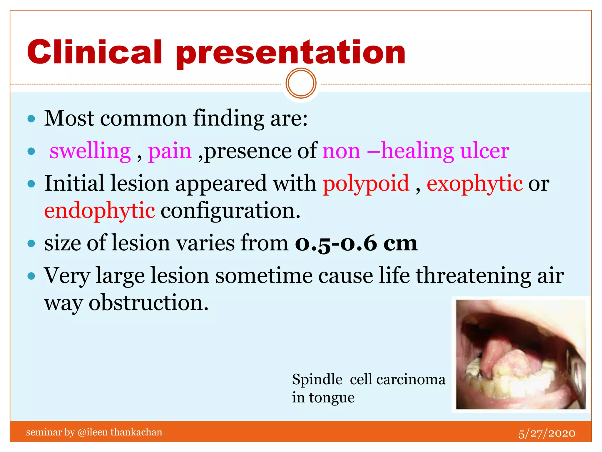 Spindle cell carcinoma | PPTX