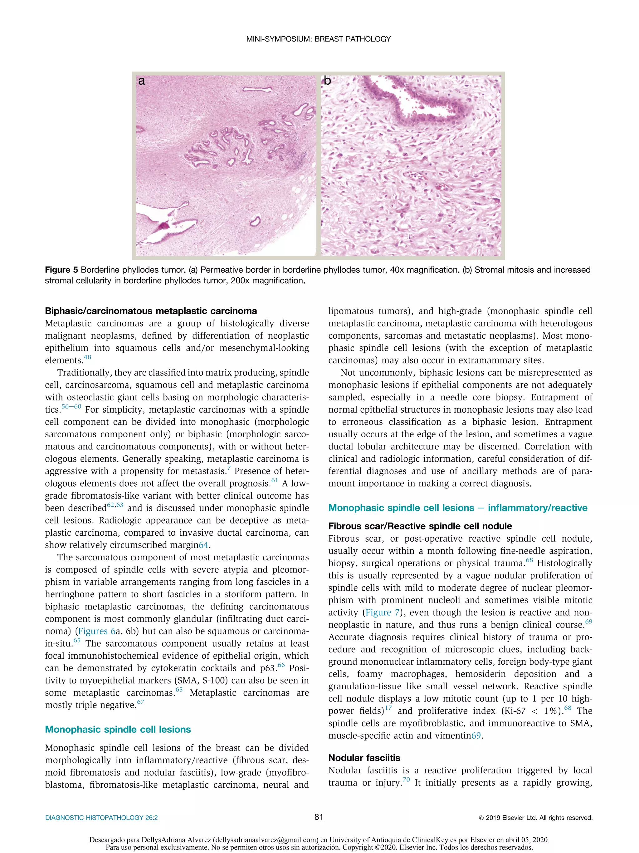 Spindle cell lesions of the breast diagnostic issues 2019 (1) | PDF