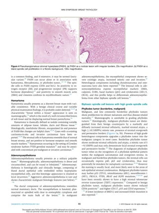 Spindle cell lesions of the breast diagnostic issues 2019 (1) | PDF