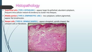 Spindle cell lesions of head & neck | PPTX