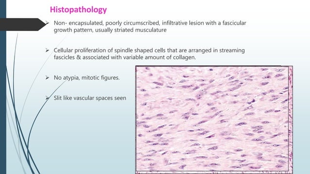 Spindle cell lesions of head & neck | PPTX | Brain and Nervous System ...