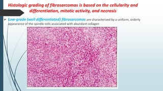 Spindle cell lesions of head & neck | PPTX