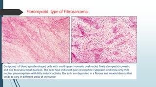 Spindle cell lesions of head & neck | PPTX