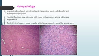 Spindle cell lesions of head & neck | PPTX
