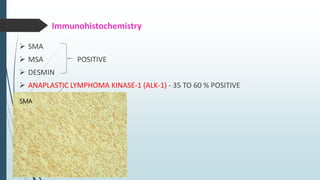 Spindle cell lesions of head & neck | PPTX