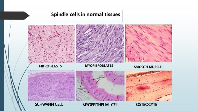 Spindle cell lesions of head & neck