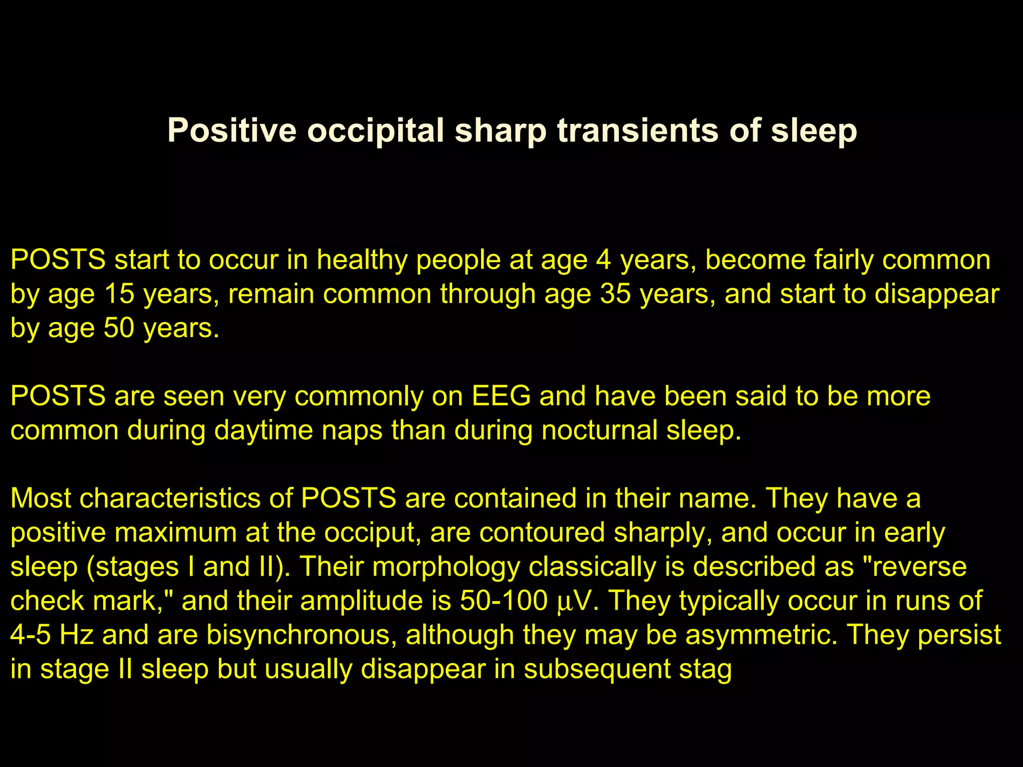Spindles and transients - Sleep Phenomena, Mechanisms and Substrates | PPT