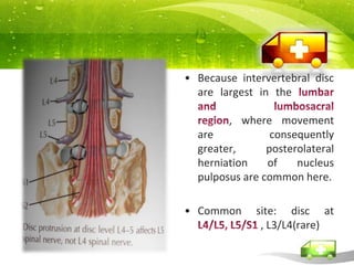 Spine | PPTX | Death, Injury, or Military Conflict | Sensitive Topics