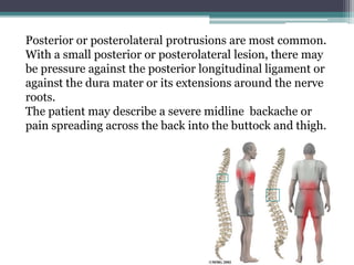 Spine.pptx and its functions with complete assesment | PPT