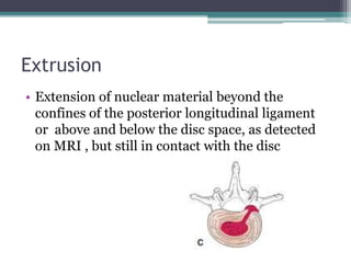 Spine.pptx and its functions with complete assesment | PPT