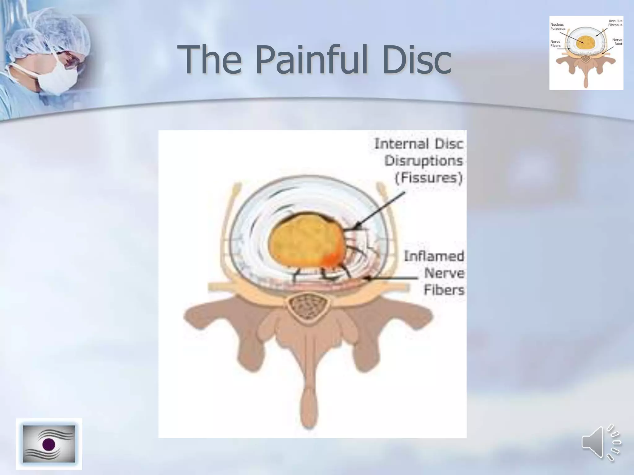 Normal Spine/Normal Disc/Painful Disc/Herniated disc | PPTX | Death ...