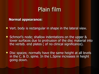 radiology.Spine 1.(dr.ameer) | PPT